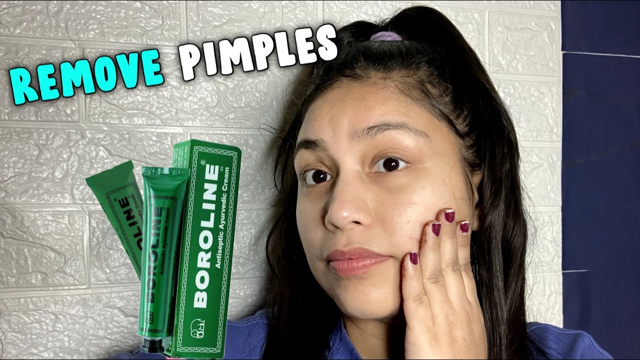 Remove Pimples & Acne in 3 Days | Natural & Easy Method - YouTube