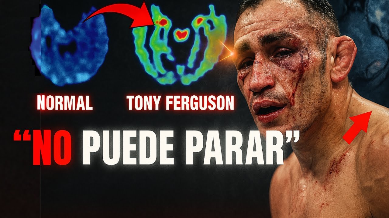 NO PUEDE PARAR.. De leyenda de la UFC a MEME El cruel destino de Tony ...