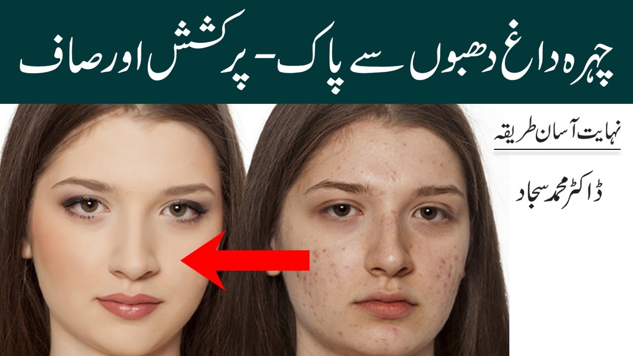 Chehre Ke Dano Ka Aasan Ilaj Face Acne Treatment At Home Life