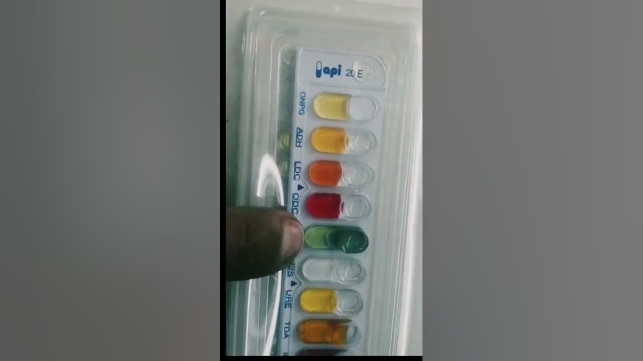 Performing API 20E Srip Test/Introduction To API Test/ Analytical ...