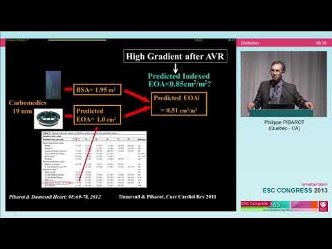 Prosthetic valve high gradient: dysfunction or mismatch - YouTube