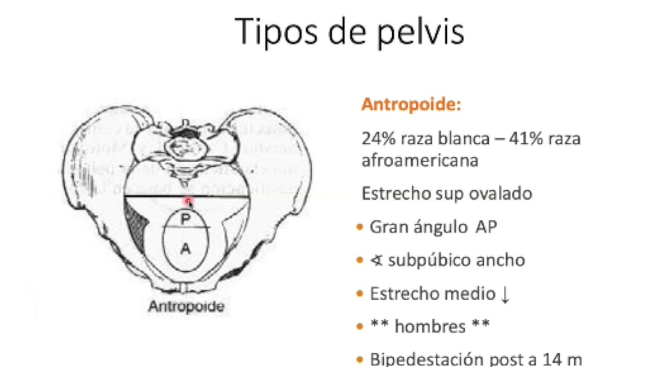 TIPOS DE PELVIS Y CARACTERISTICAS - YouTube