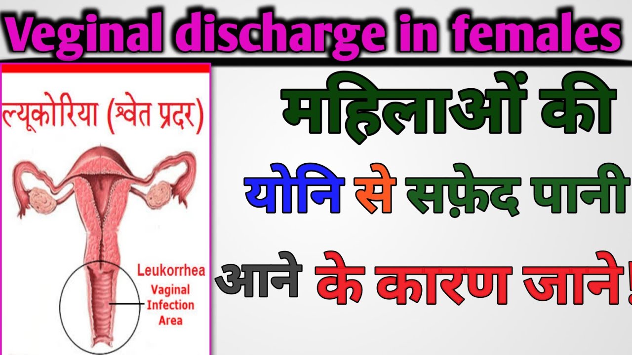 Veginal Discharge| योनि से सफेद पानी आने के कारण! Leucorrhoea| White ...