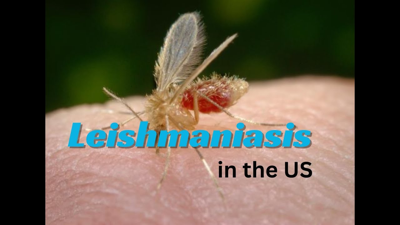 Leishmaniasis in the US with Naomi Aronson, MD - YouTube