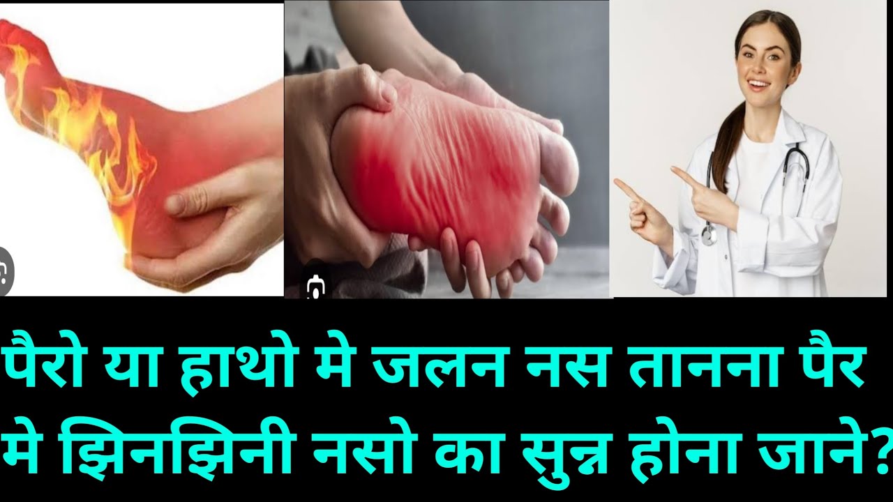 pairo me jalan ya sunapan ki perfect Alopaithy Medicines janiye? - YouTube
