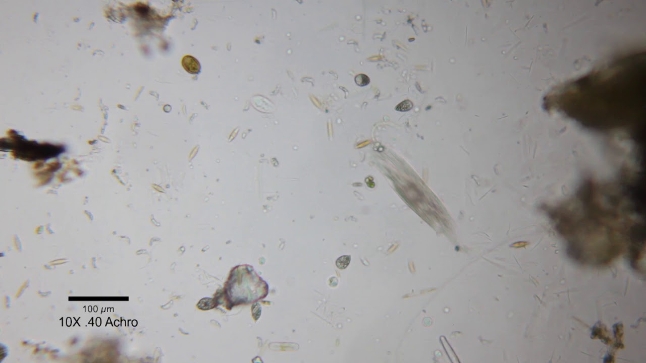 Pond Life Through the Microscope: Knowns and Unknowns 2 - YouTube