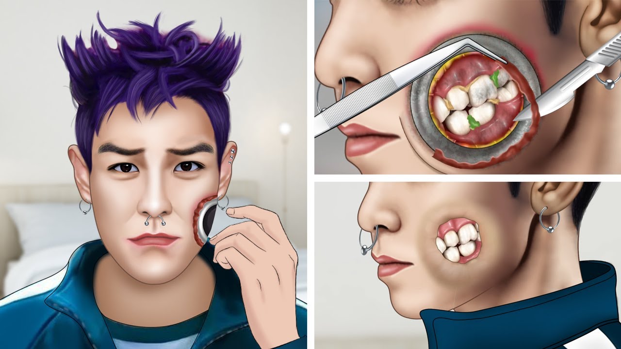 [ASMR Animation] Help Thanos remove long-term pus piercings - YouTube