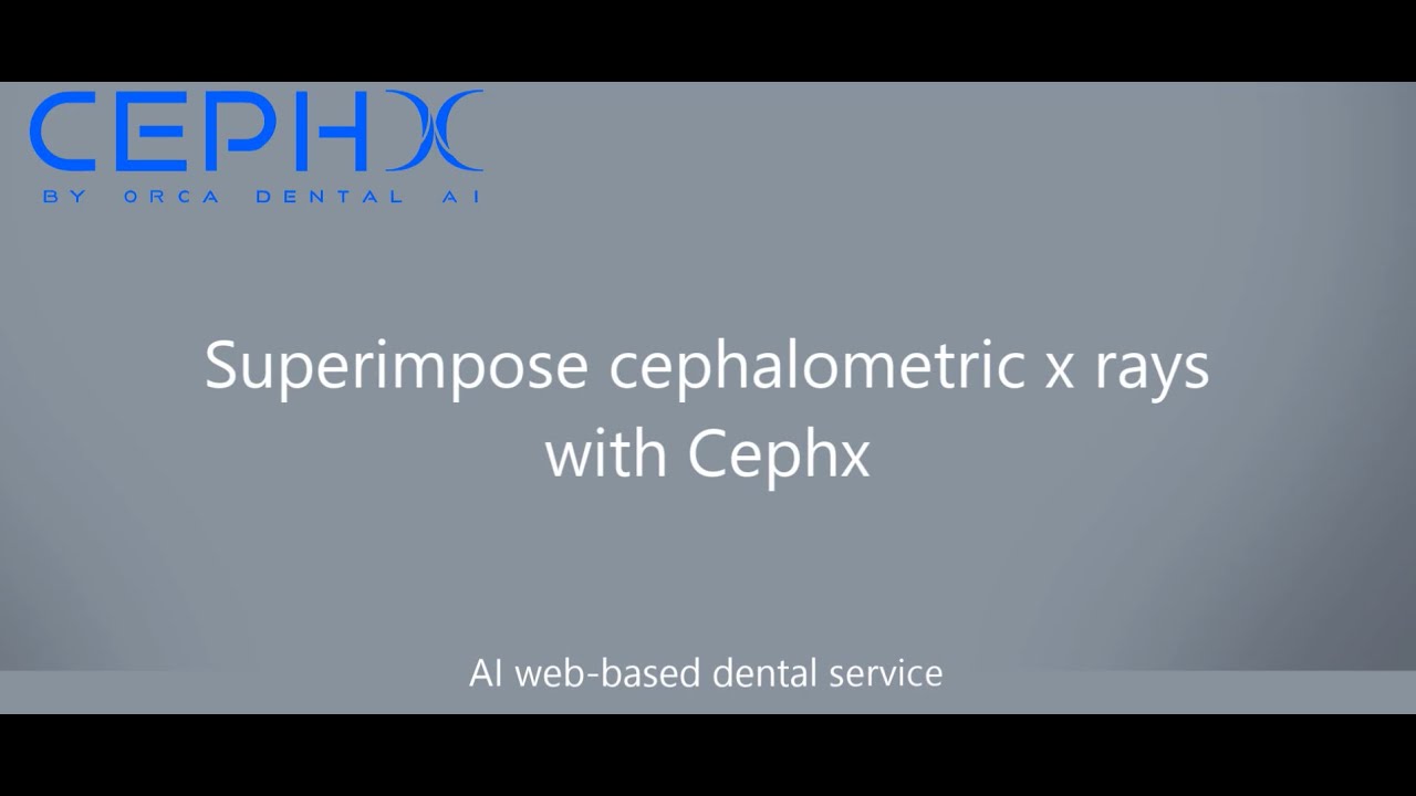 Superimpose cephalometric x rays with Cephx Superimposition - YouTube