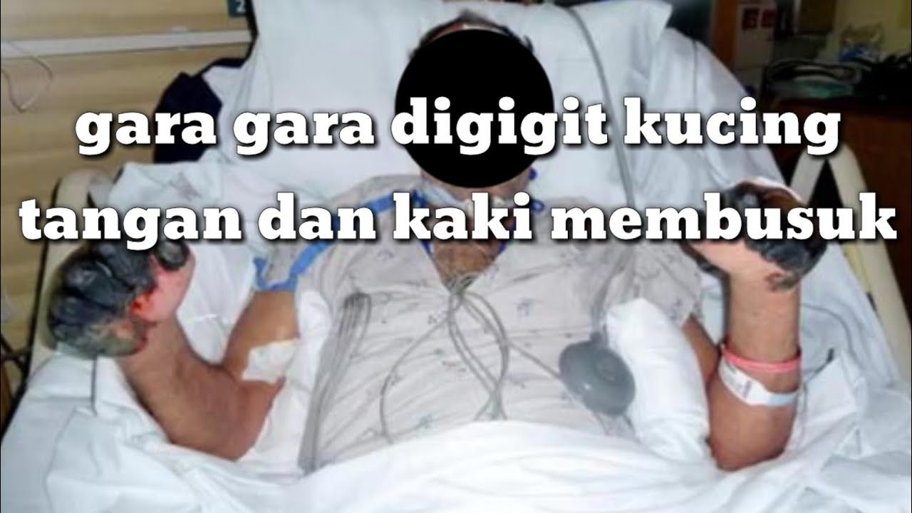 Digigit kucing,tangan dan kaki pria ini membusuk - YouTube
