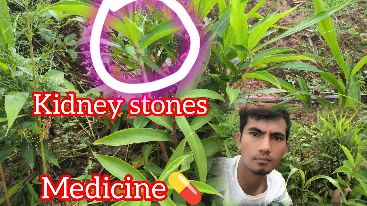 😱🔥Kidney stones remedies,Kal a song(stone)um thah lhah natheilou # ...