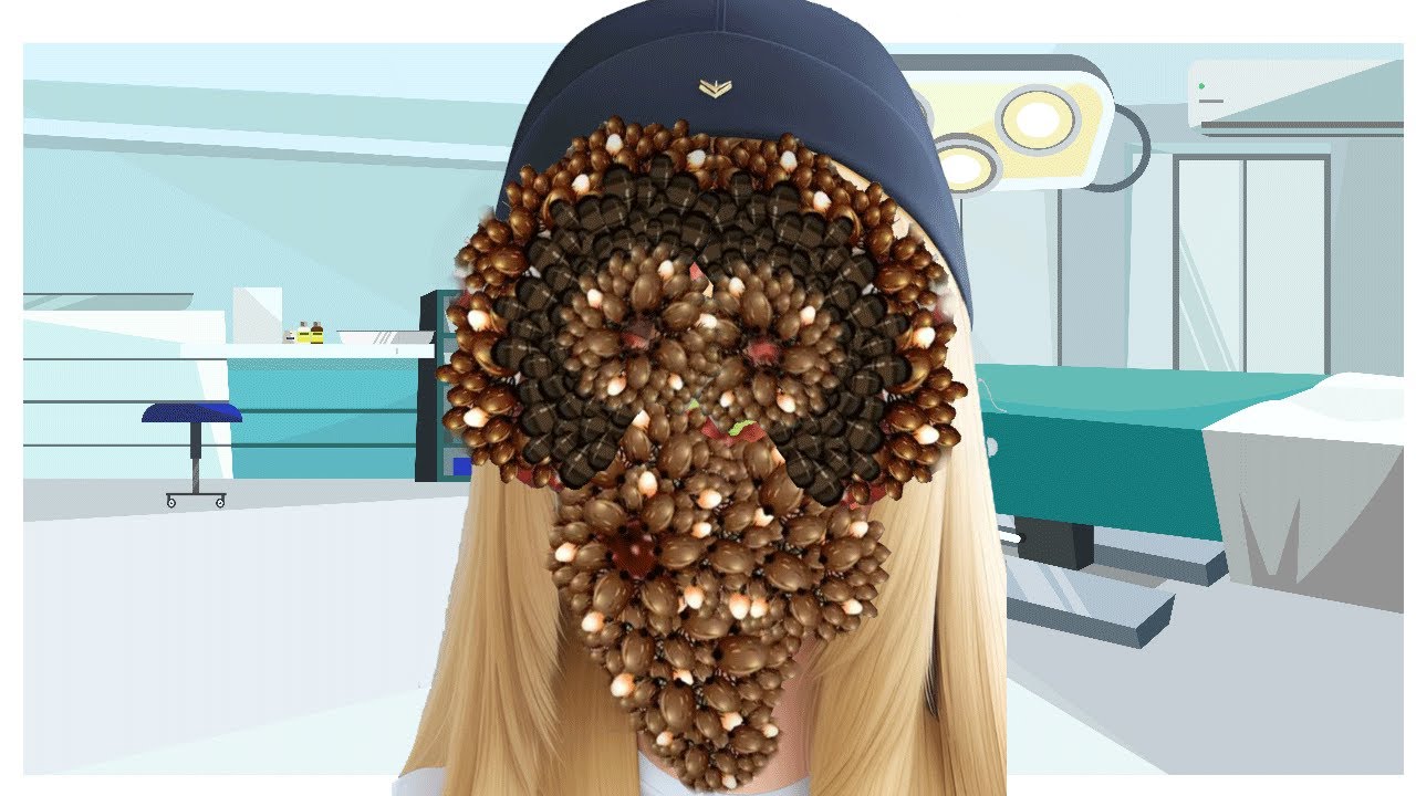 ASMR Remove Big Acne, dog tick & Worm Infected Zombie girl Face |ASMR ...