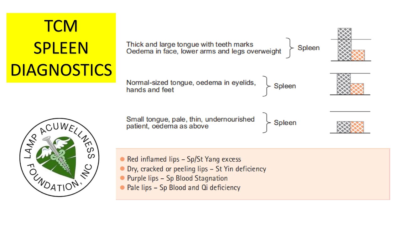 TCM SPLEEN DIAGNOSTICS - YouTube