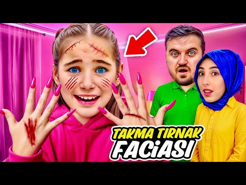EYVAH ELİF SİNEM TIRNAKLARI KESMEDEN UYUDU !! YÜZÜNE NOLDU ?? 