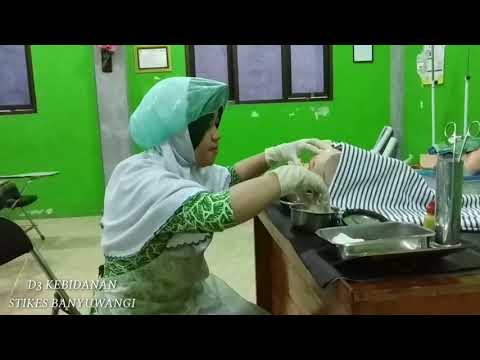 PERAWATAN INFEKSI LUKA PERINEUM - YouTube