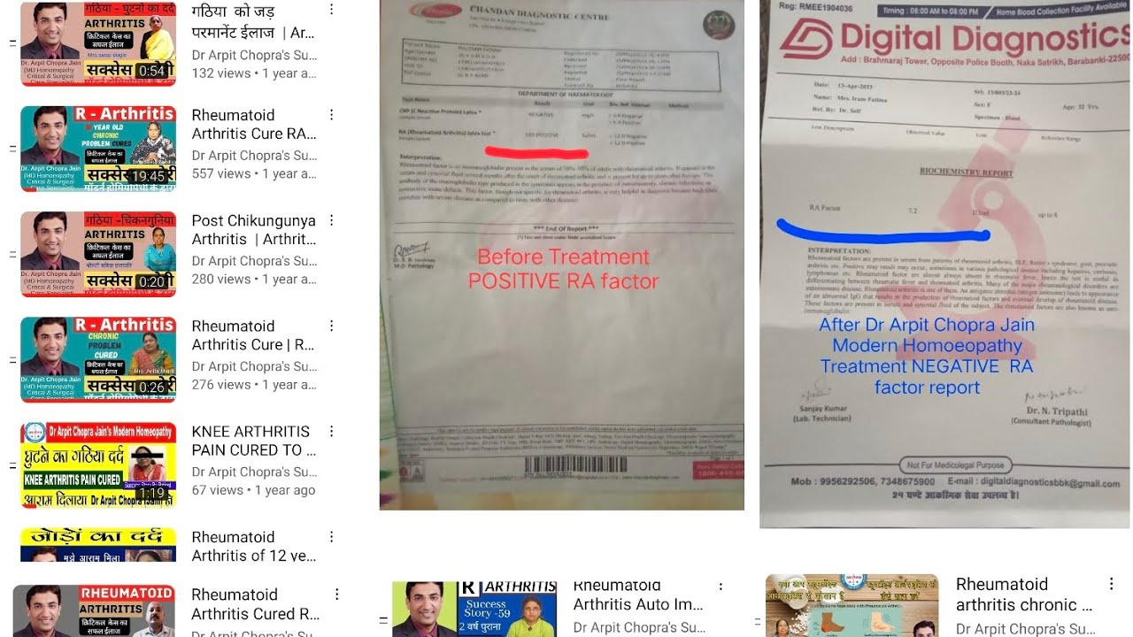 Rheumatoid Arthritis Positive RA Factor to Negative by Dr Arpit Chopra ...