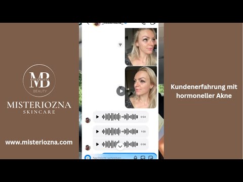 Meine Reise mit hormoneller Akne: Wie Misteriozna Beauty meine Haut gerettet hat!