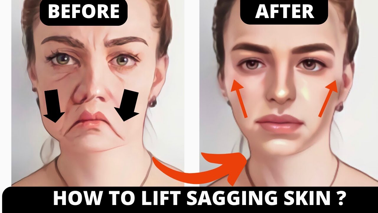 Tighten Saggy Skin & Saggy Cheeks in 2 Weeks ! No Surgery! Sculpt Your ...