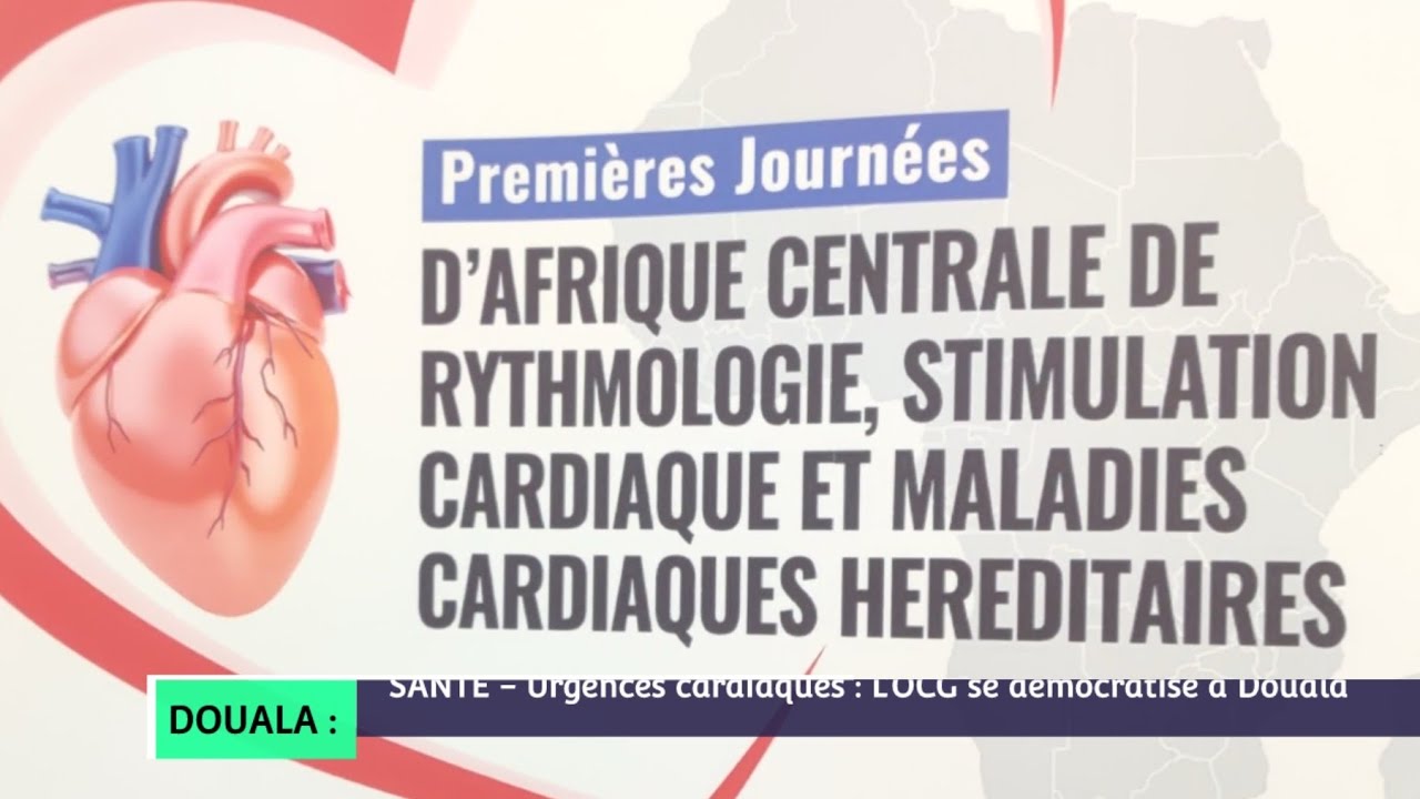 DOUALA : SANTE - Urgences cardiaques : L’ECG se démocratise à Douala ...