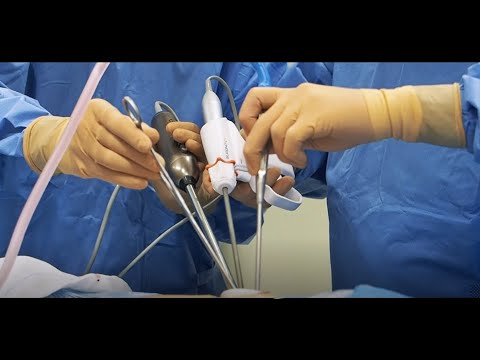 Surgnova assisted Dr. Diego González Rivas with a case of uniportal ...