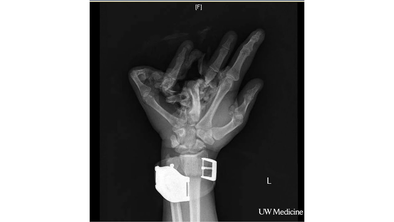 Fireworks facts for an injury-free July Fourth weekend - YouTube