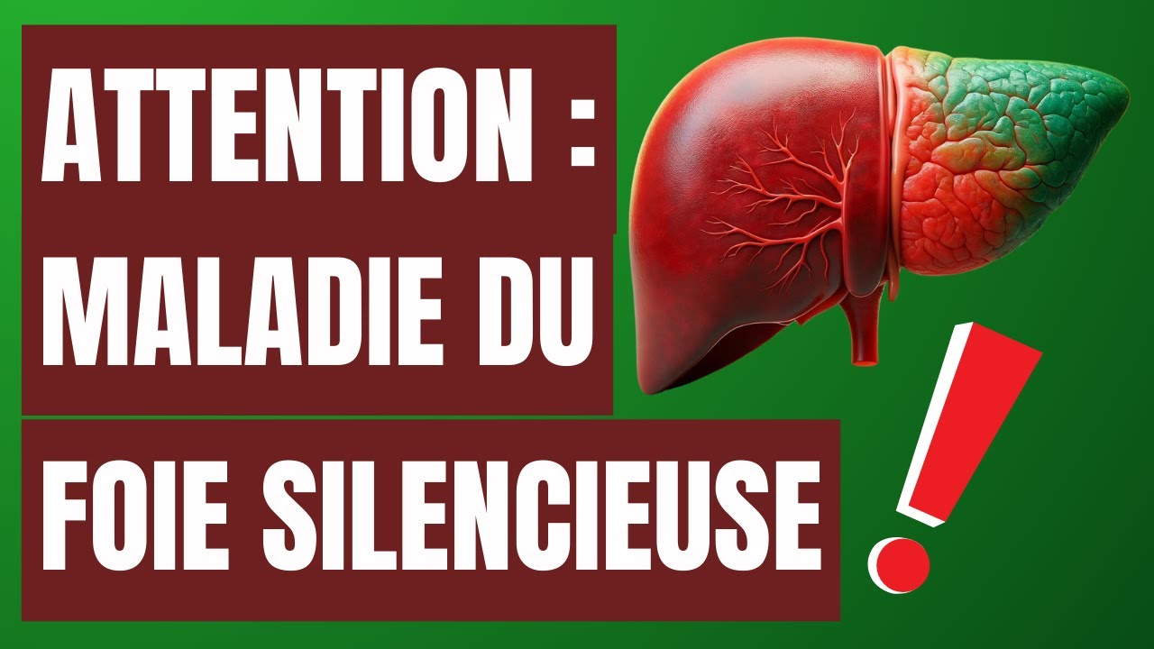 Comment J'AI DÉTECTÉ Ces 8 Signes Visibles de la Maladie du Foie ! # ...