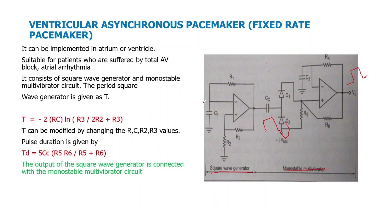 Cardiac Pacemaker - 1 - YouTube