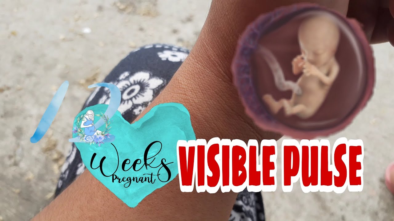 12 WEEKS PREGNANT: VISIBLE PULSE IN WRIST IN PREGNANT WOMEN - YouTube