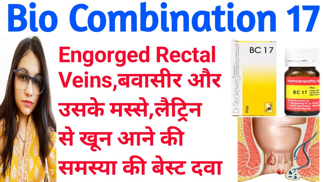 Bio Combination 17 | बवासीर के मस्से की बेस्ट दवा | Engorged Rectal ...