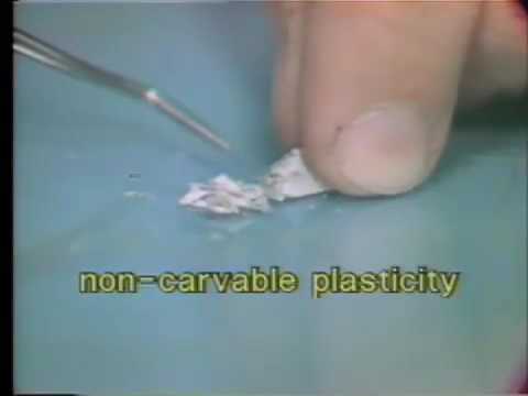 Introduction to Amalgam - Capmaster Tytin - YouTube
