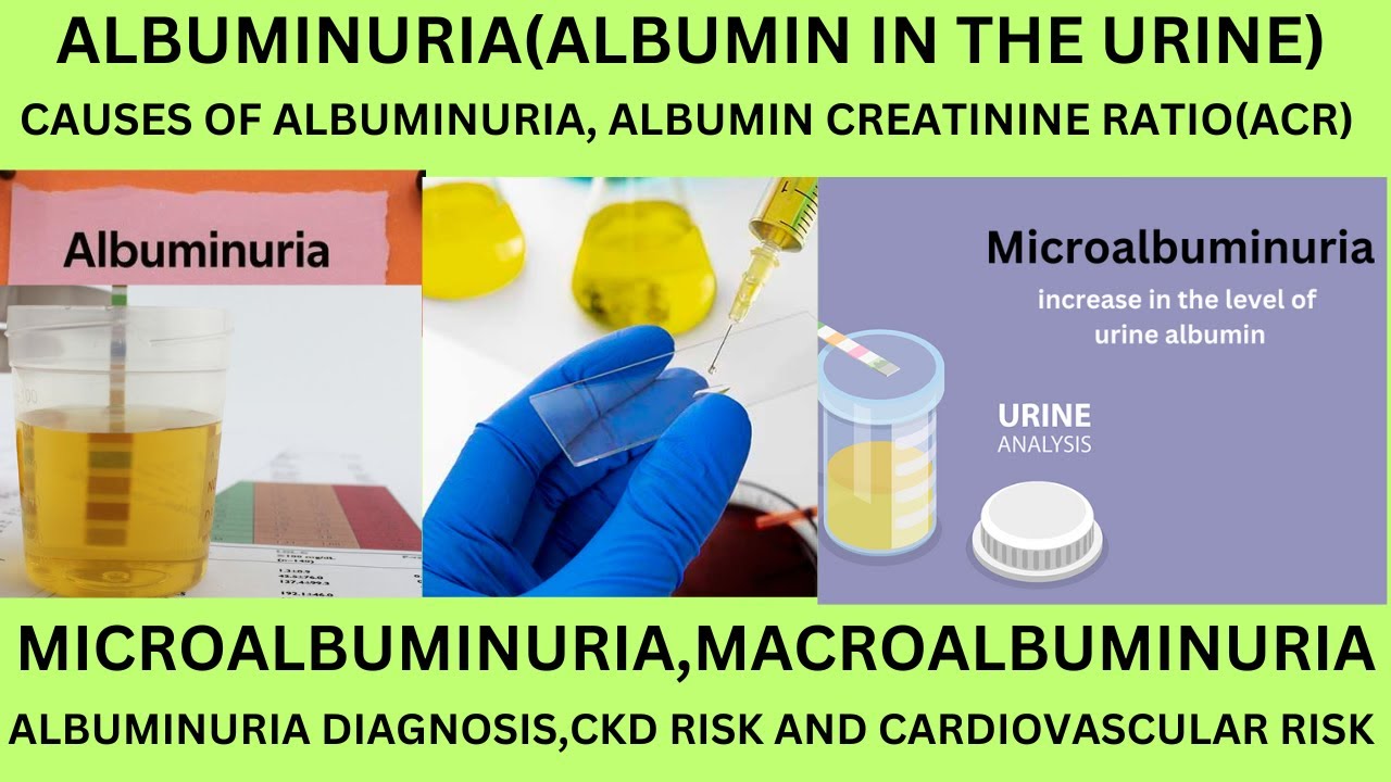CAUSES SYMPTOMS AND GRADES OF ALBUMINURIA.MICROALBUMINURIA ...