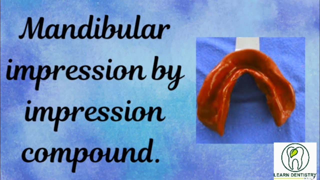 Mandibular impression by impression compound. - YouTube
