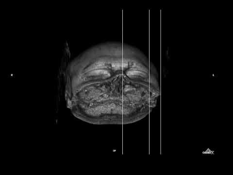 mri half shell - YouTube