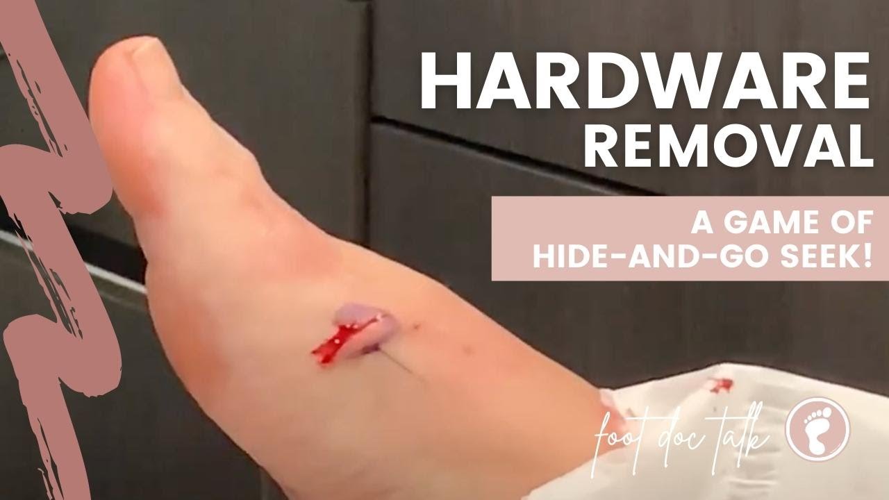 Hardware 🔨 removal?! - YouTube