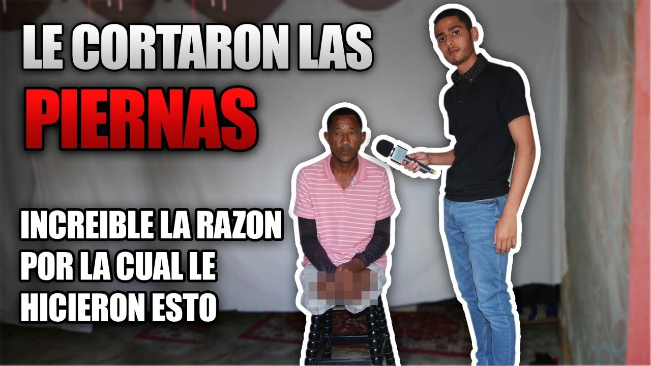 Le CORTARON las PIERNAS! No creerás ¿POR QUE? le hicieron esto ! - YouTube