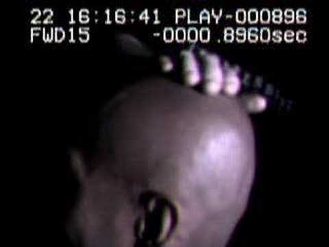 bald head slap - YouTube