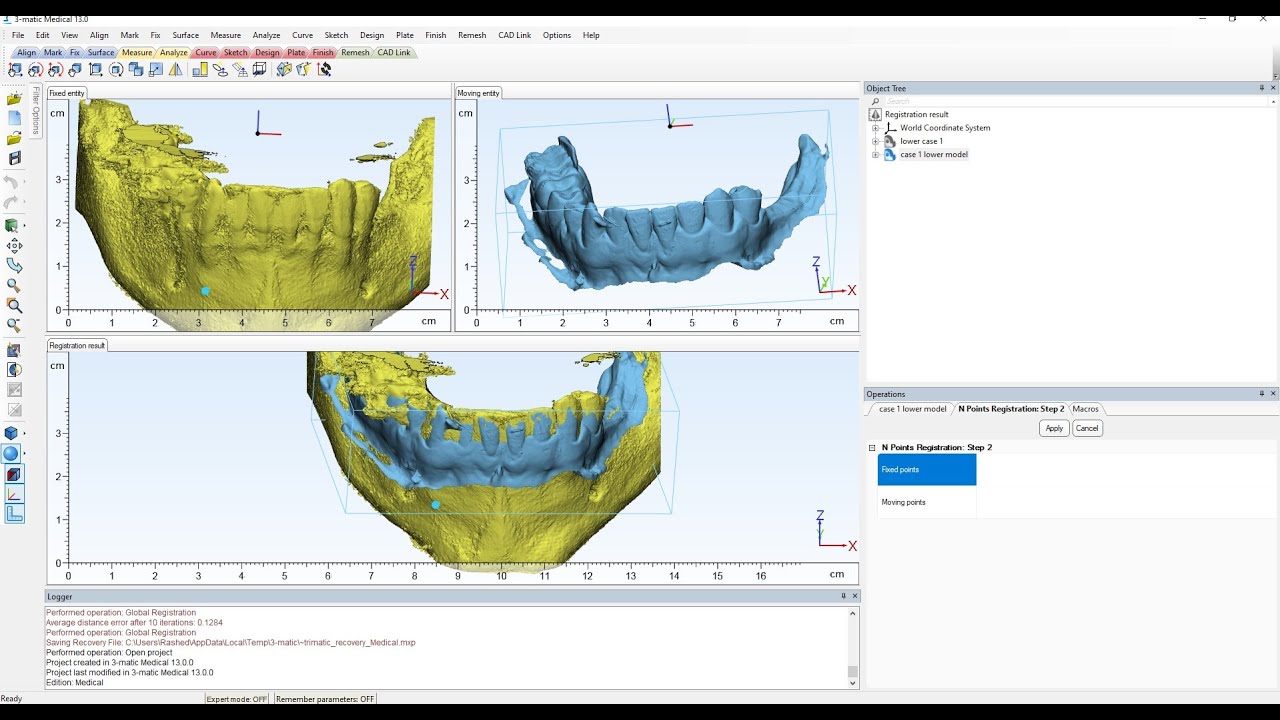 3 matic materialse mimics 3d model aligning with cbct model (lesson(3) - YouTube
