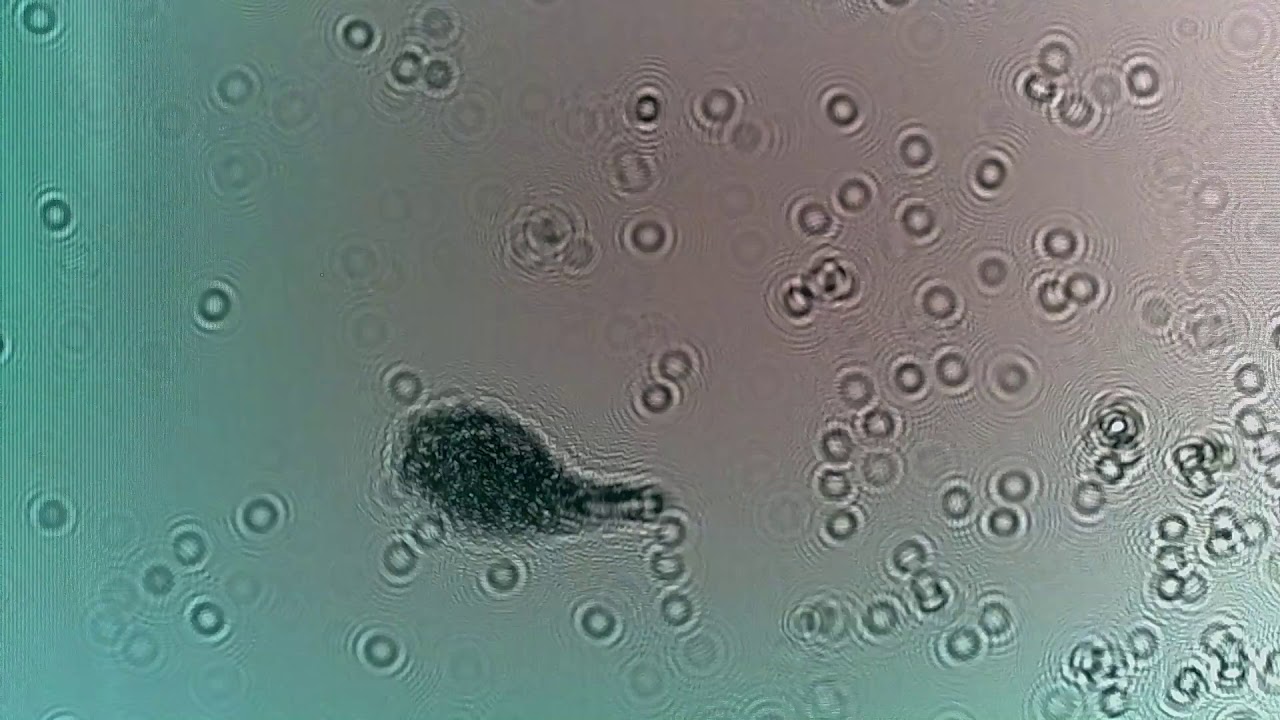 Direct InLine Holographic Microscope (DIHM) - YouTube