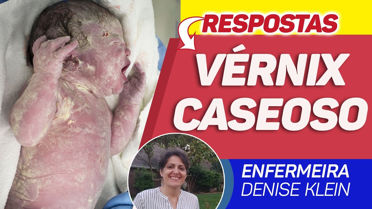 Vérnix Caseoso - YouTube