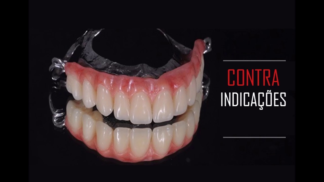 PPR Indicações e Contraindicações - YouTube