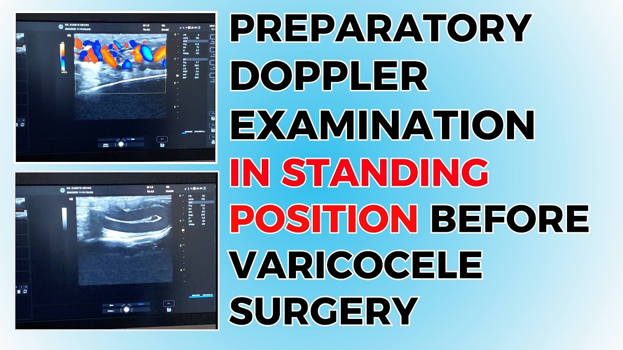 Preparatory Examination Before Varicocele Surgery - Doppler examination ...