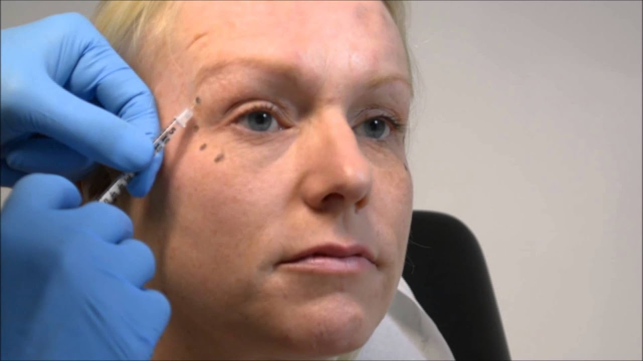 Lisa's Botox Treatment - Assured Aesthetics - YouTube