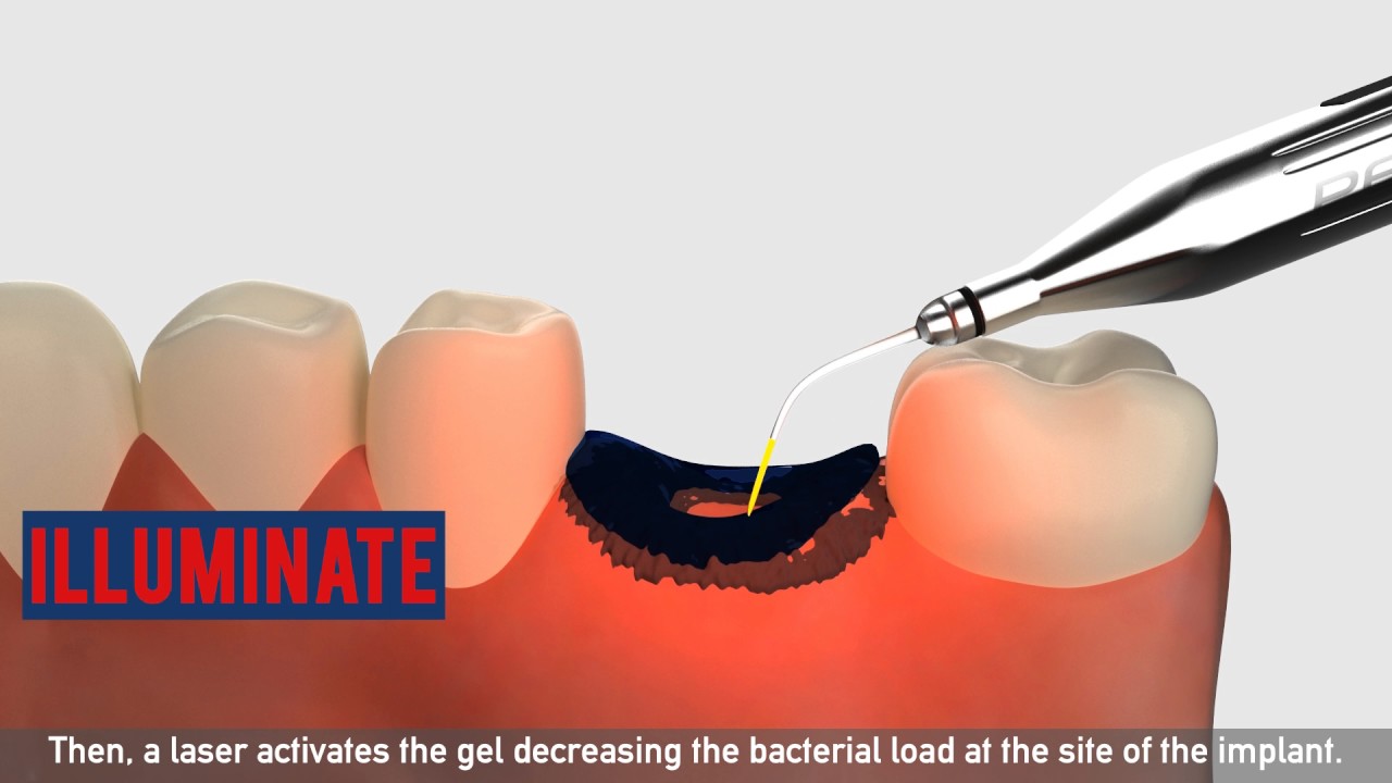 Explainer video for Periowave by Square Pixel - YouTube