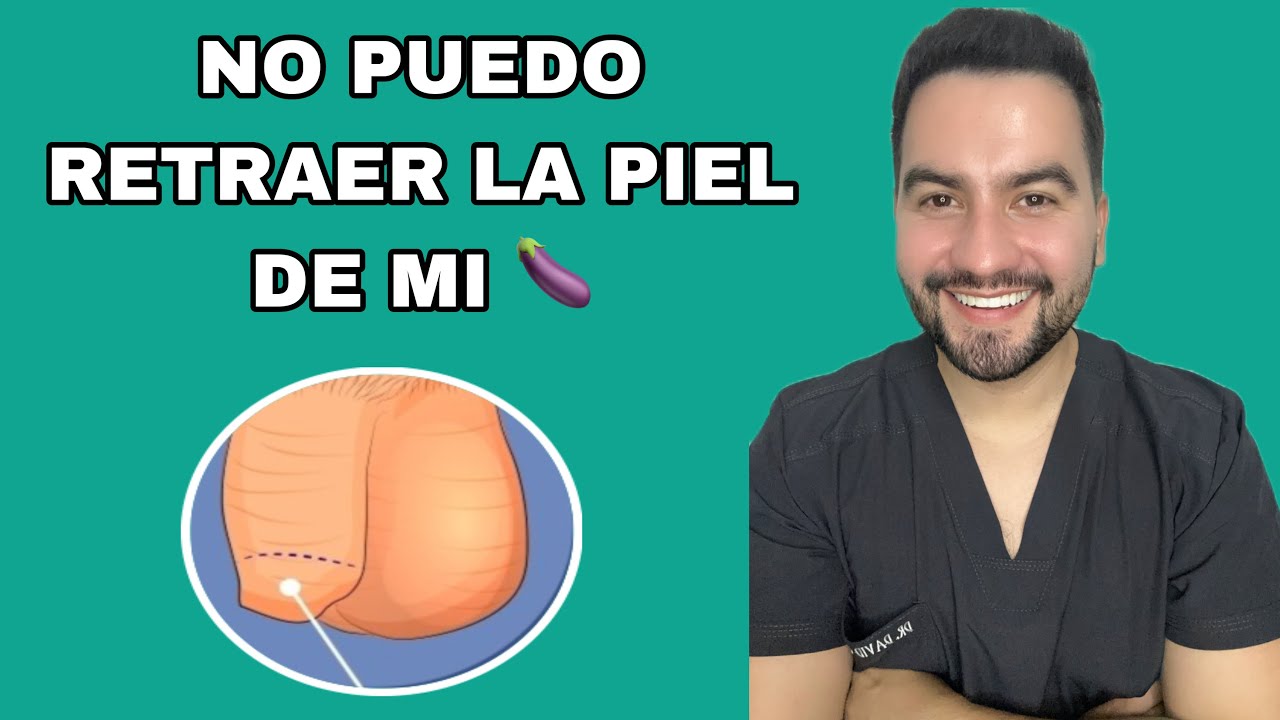 TENGO FIMOSIS / NO PUEDO PELAR MI PENE | Dr. David Campos - YouTube