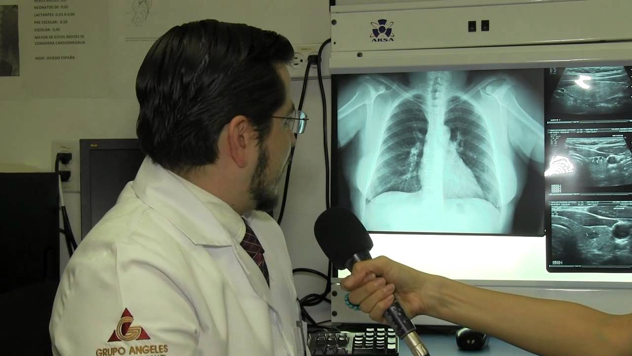 NOTA QUE ES UN RADIOLOGO - YouTube