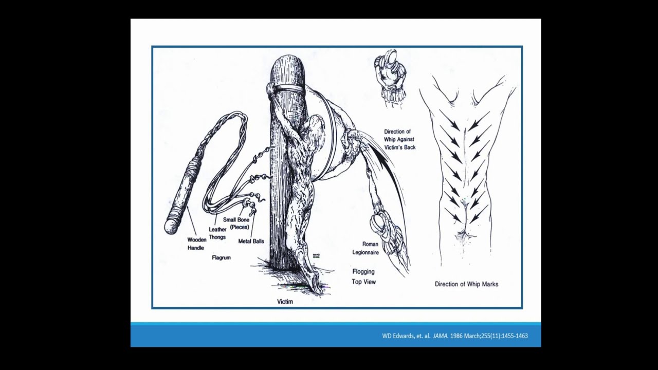 The Physical Death of Jesus Christ: A Medical Evaluation - YouTube