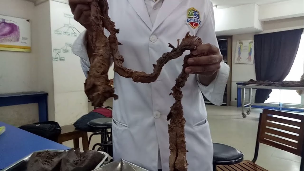 Intestine of human II Original cadaver mbbs 1st year demonstration ...