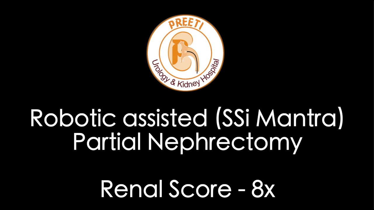 Robotic assisted (SSi Mantra) Partial Nephrectomy Renal Score - 8x ...
