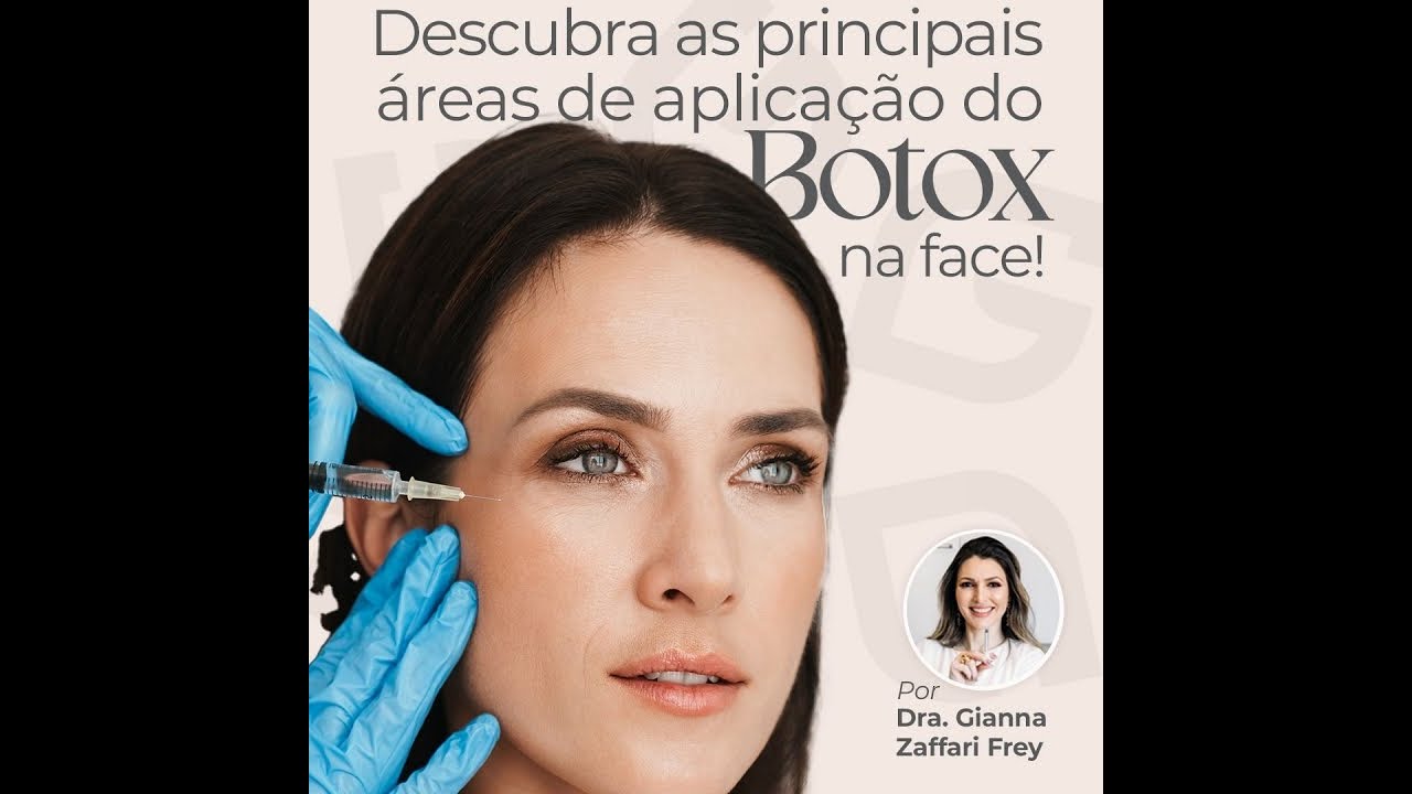 Descubra as principais áreas de aplicação do Botox na face! - YouTube