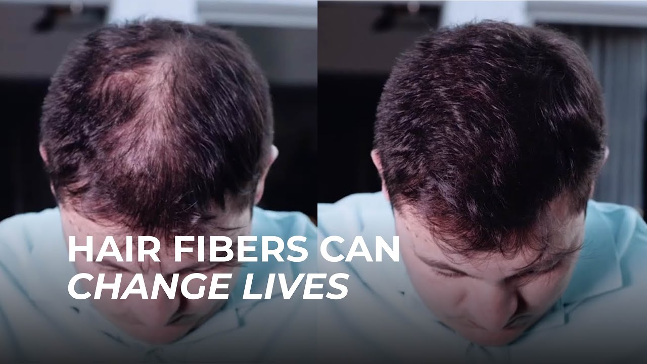 Hair Fibers can change lives: Hear their stories - YouTube