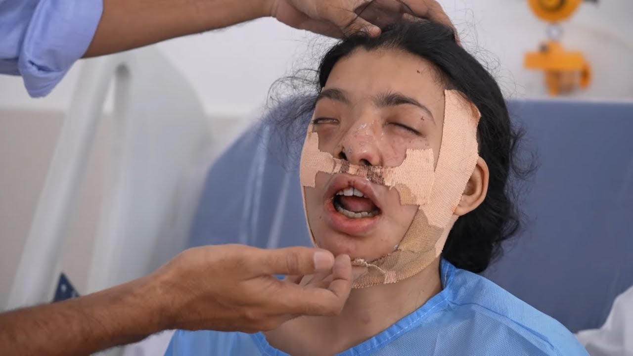 Giving NEW FACE to a Girl | Plastic Surgery | Shocking Results - YouTube
